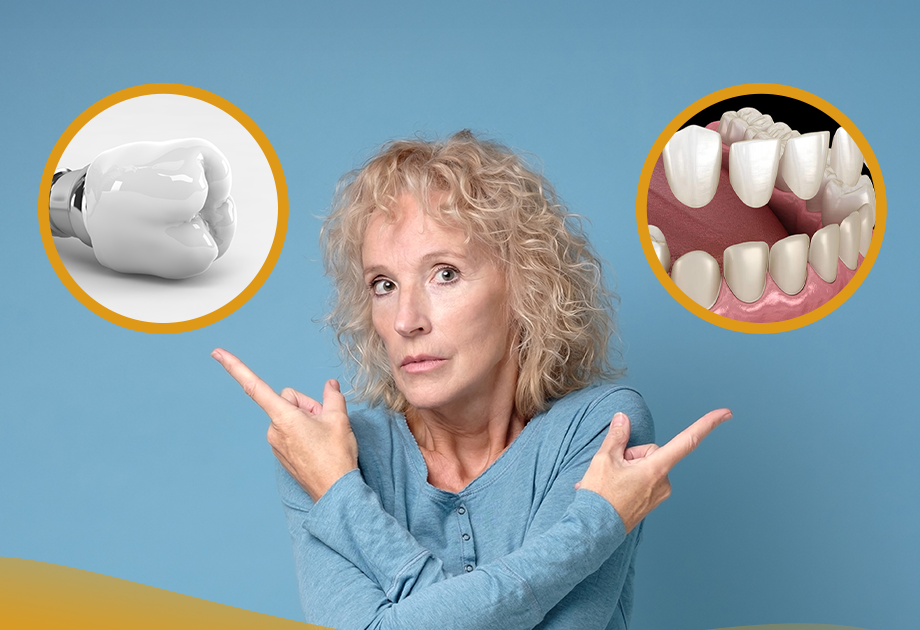 Facette dentaire ou couronne : quelle est la différence et quand ...